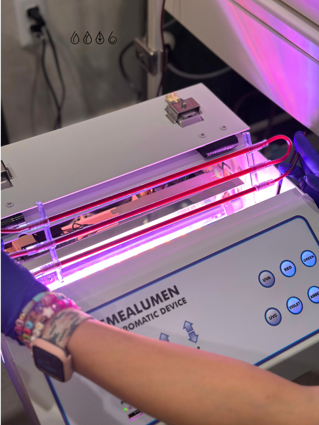 Ultraviolet Blood Irradiation Therapy (UBVI): Benefits and Treatment